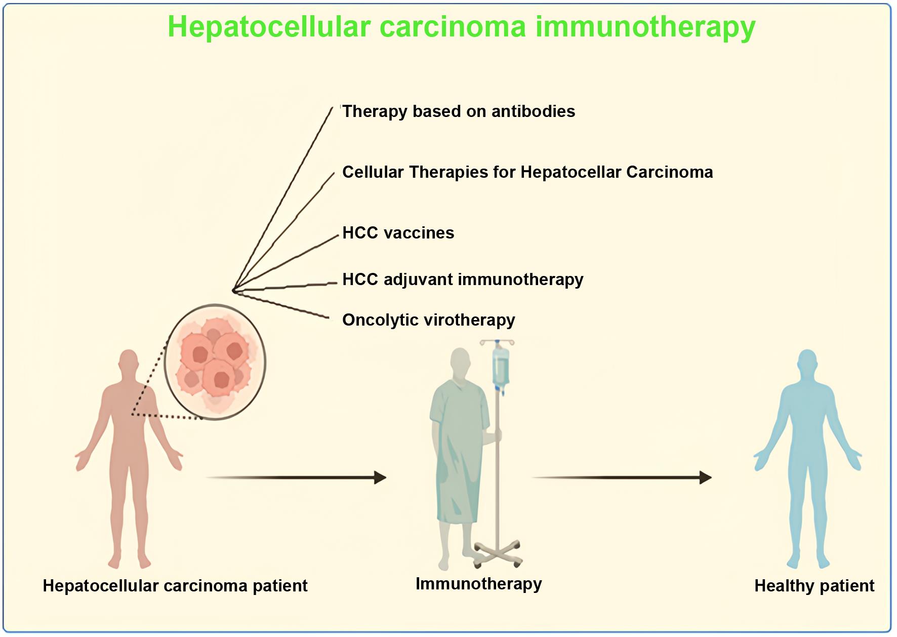 Treatment Options for Hepatocellular Carcinoma Using Immunotherapy: Present and Future