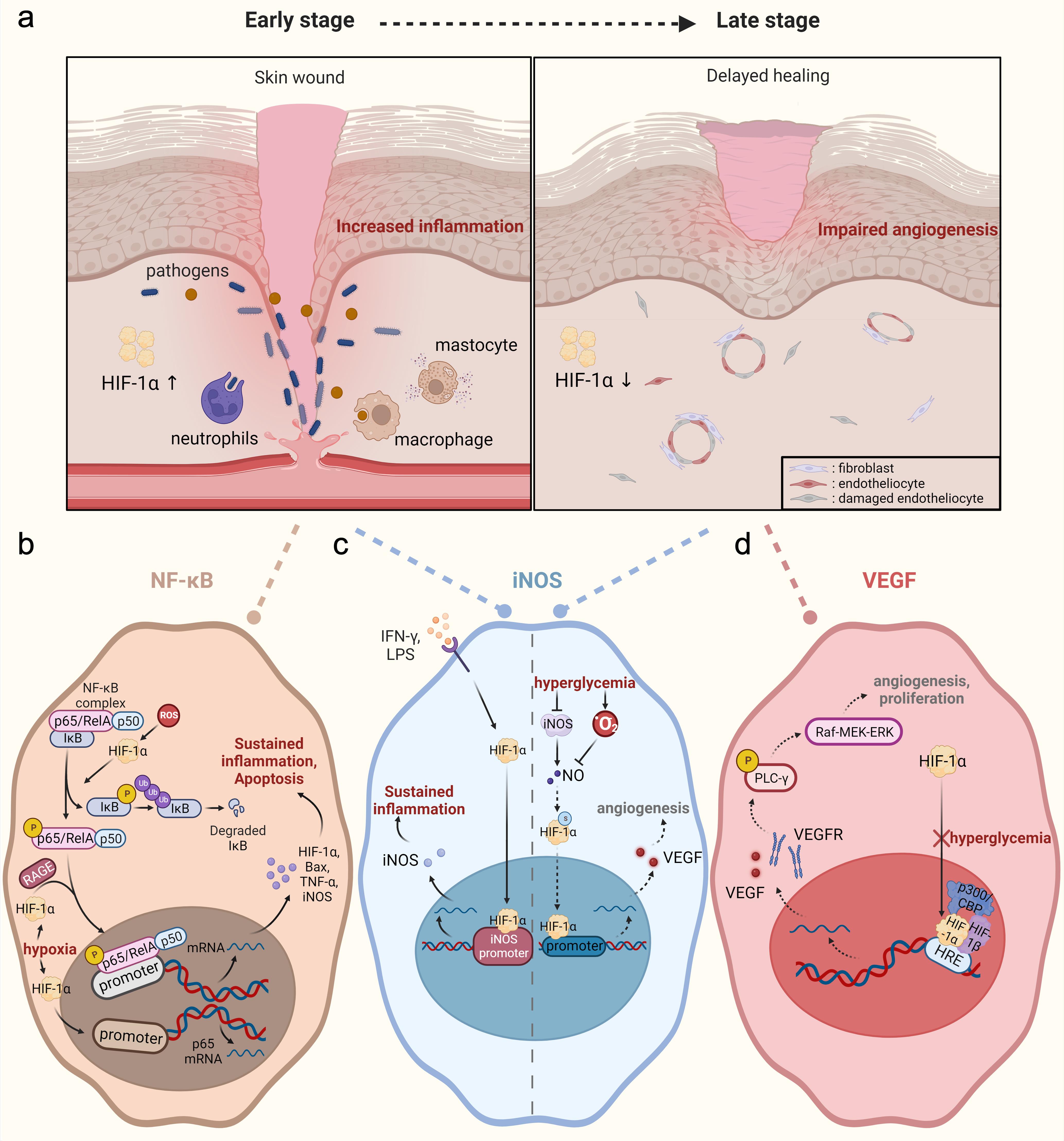 Hypoxia-inducible Factor-1α in Diabetic Foot Ulcers: Plain but Not Simple