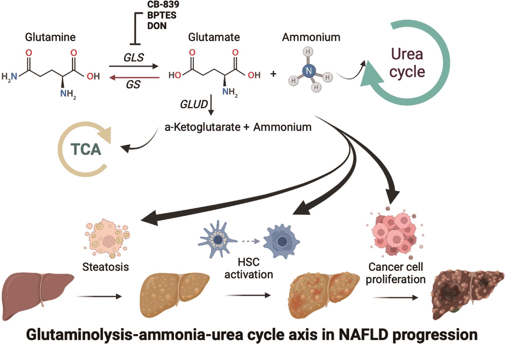 Glutaminolysis ammonia urea Cycle Axis Non alcoholic Fatty Liver