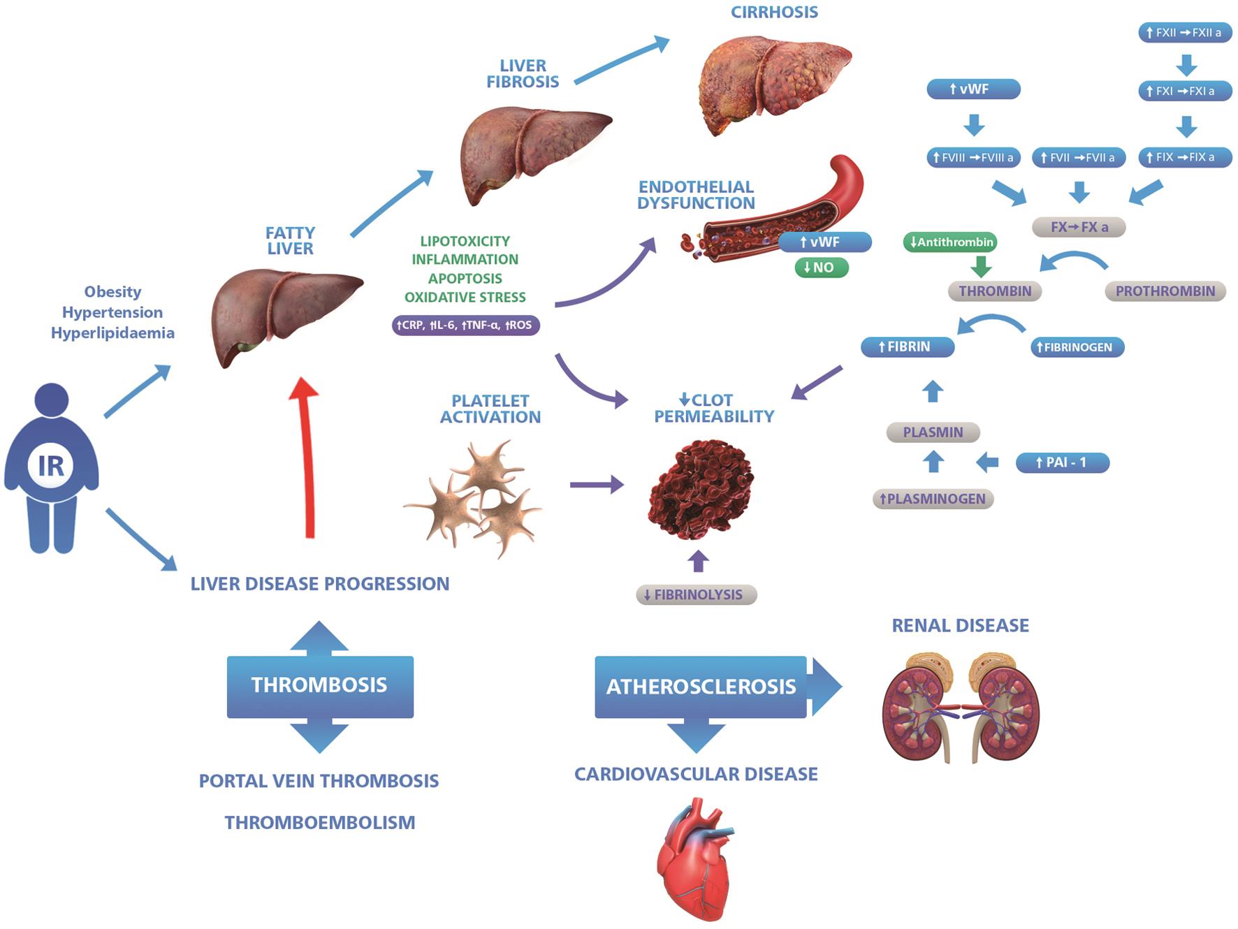 Coagulation and Endothelial Dysfunction Associated with NAFLD: Current ...