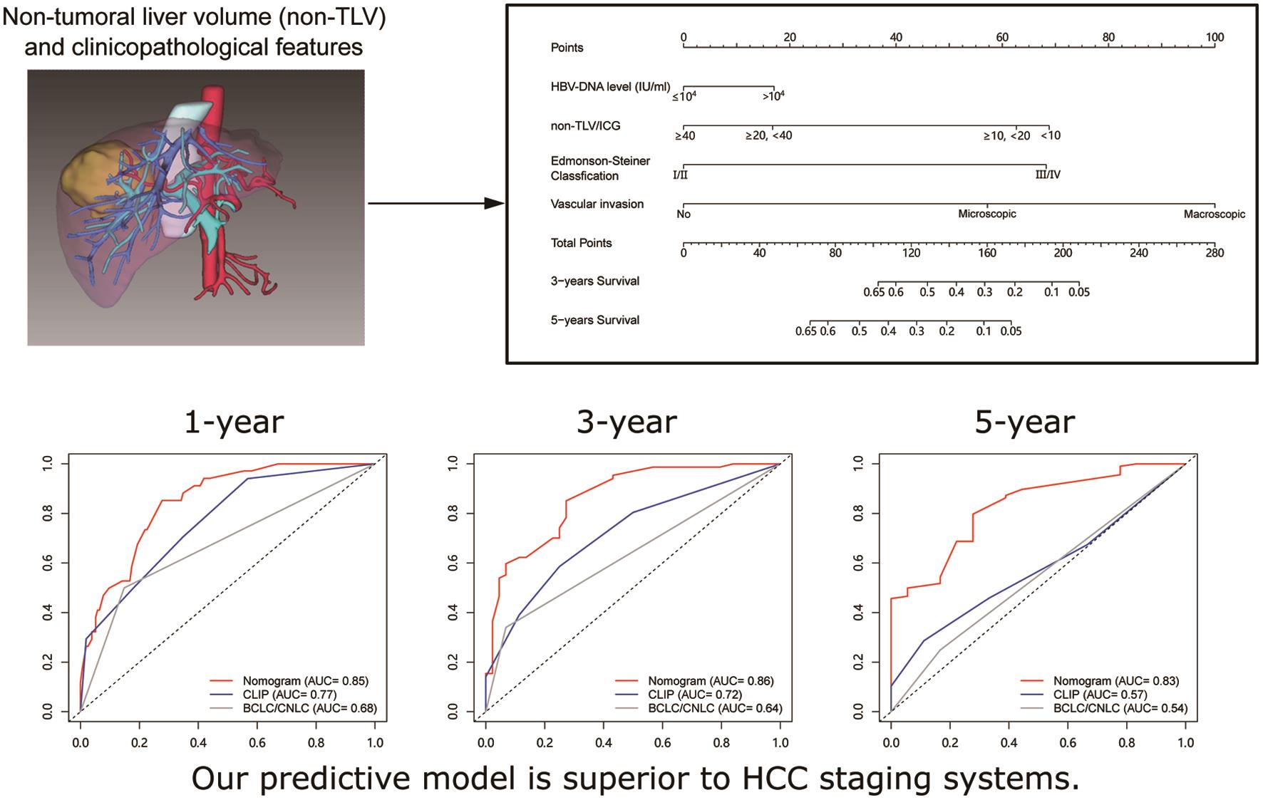 Value of Non-tumoral Liver Volume in the Prognosis of Large ...