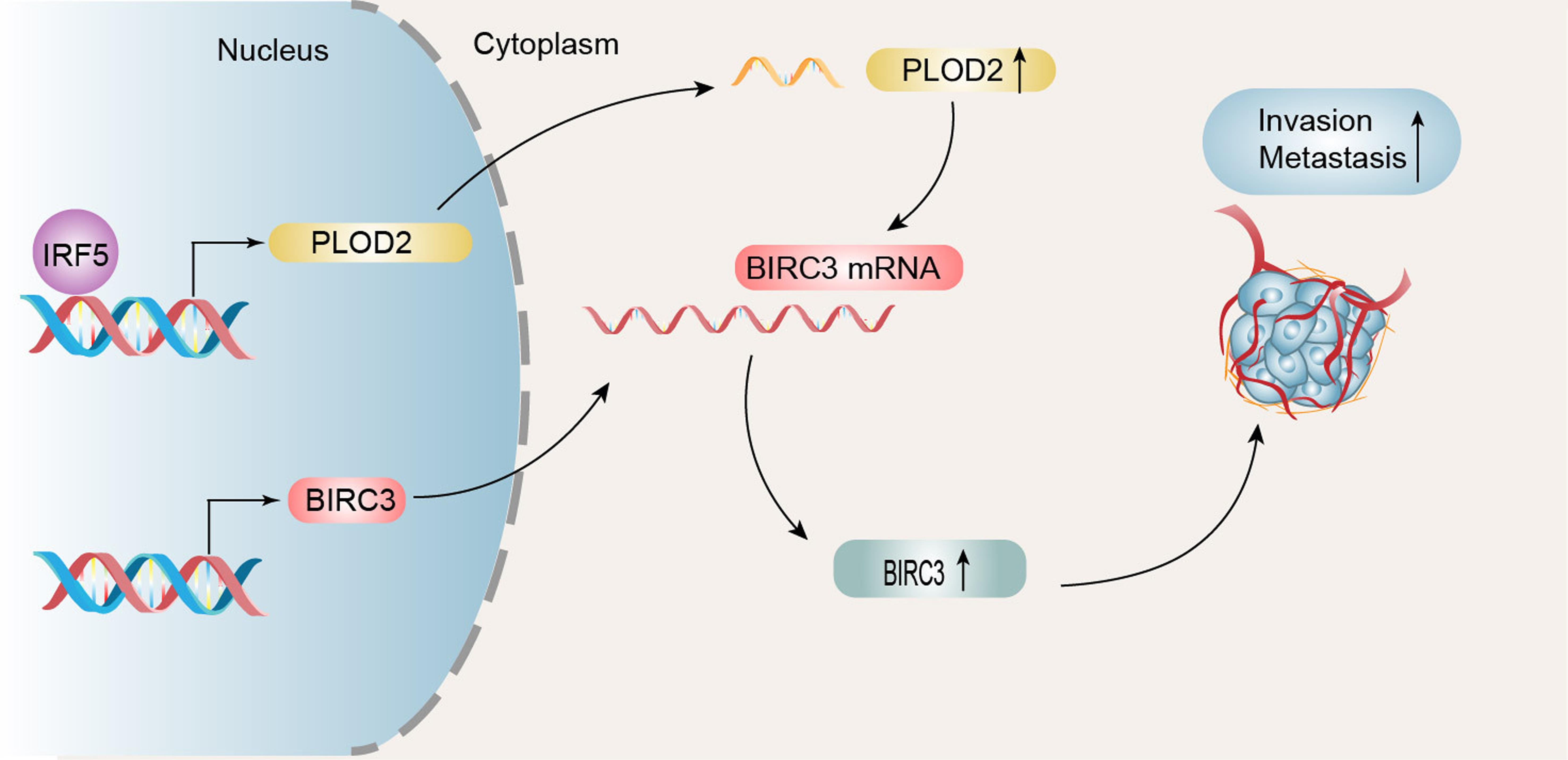 Dysregulation of PLOD2 Promotes Tumor Metastasis and Invasion in ...