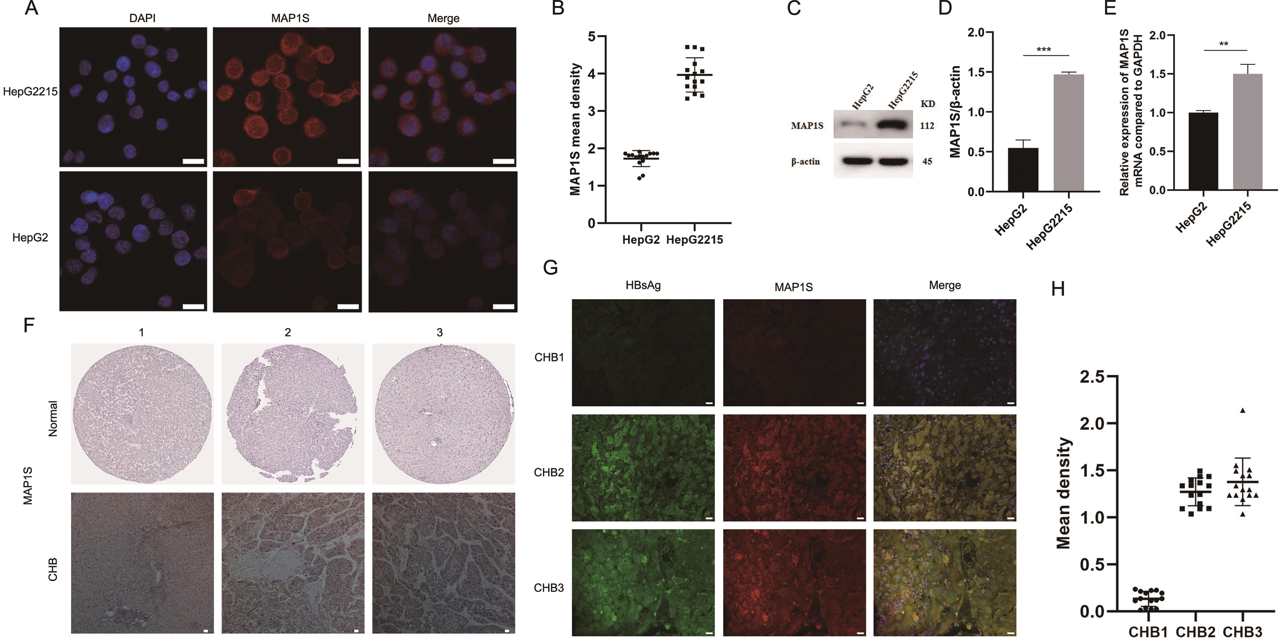 Hepatitis B Virus Induces Microtubule Stabilization to Promote ...