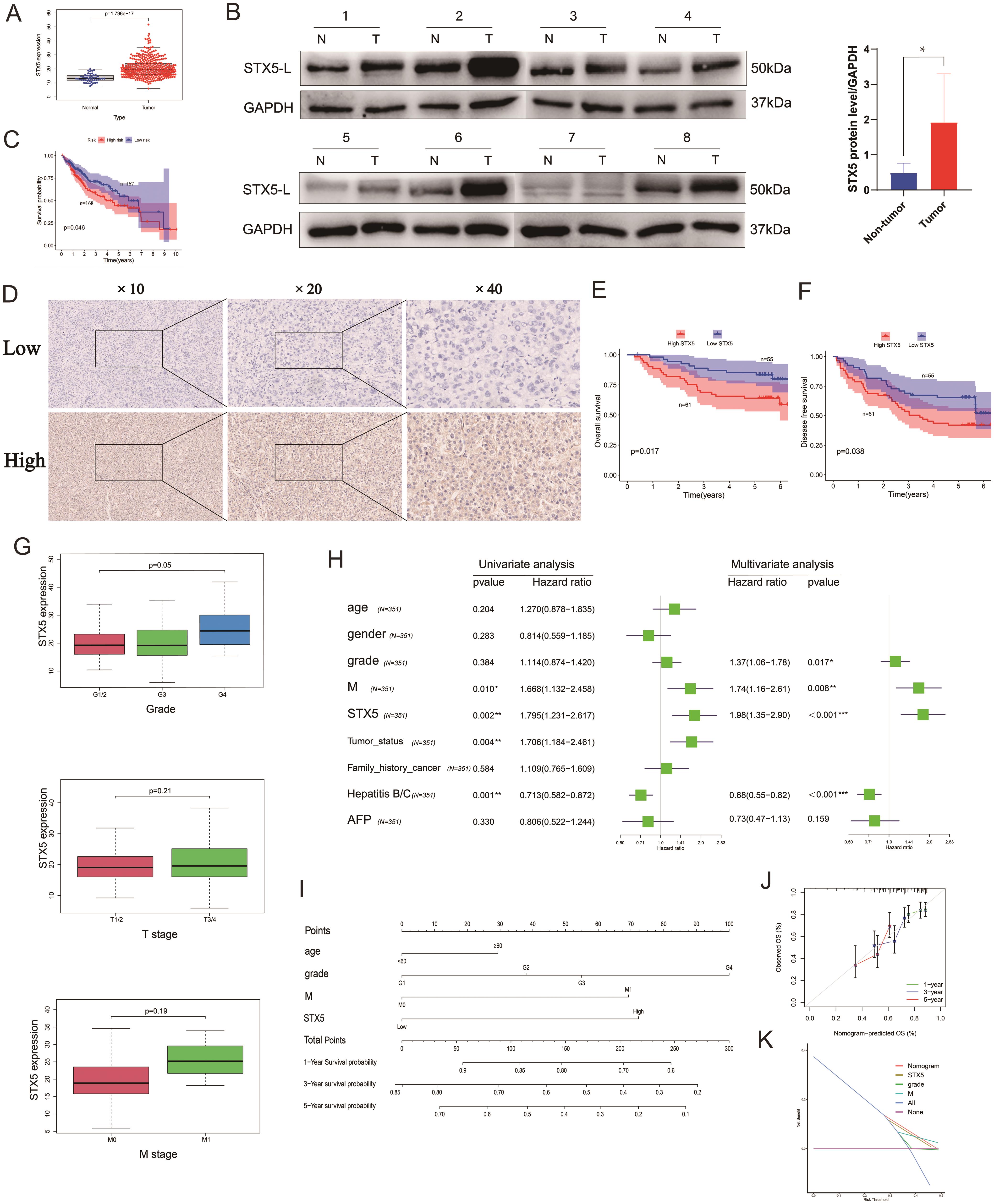STX5 Inhibits Hepatocellular Carcinoma Adhesion and Promotes Metastasis ...