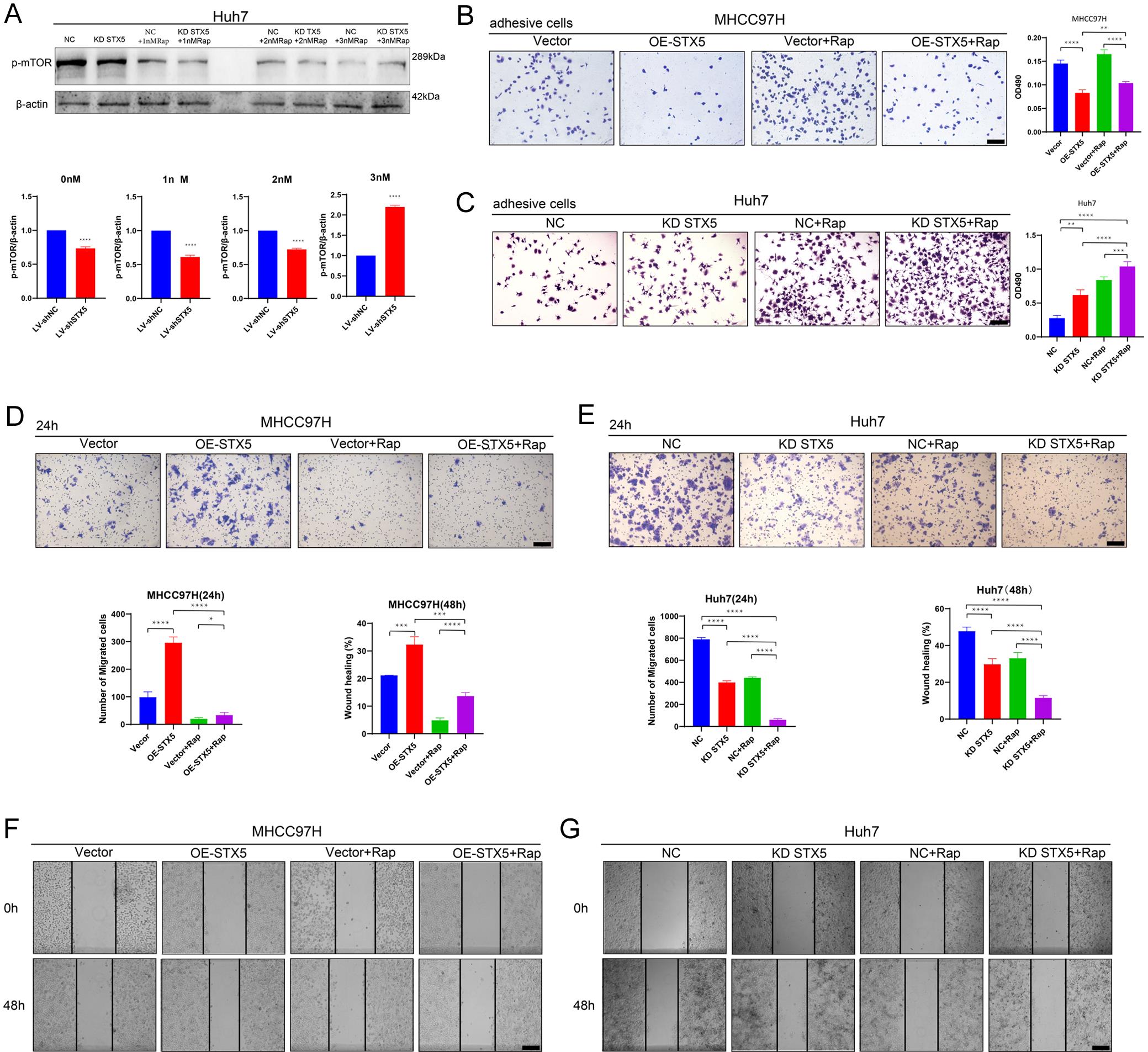 STX5 Inhibits Hepatocellular Carcinoma Adhesion and Promotes Metastasis ...