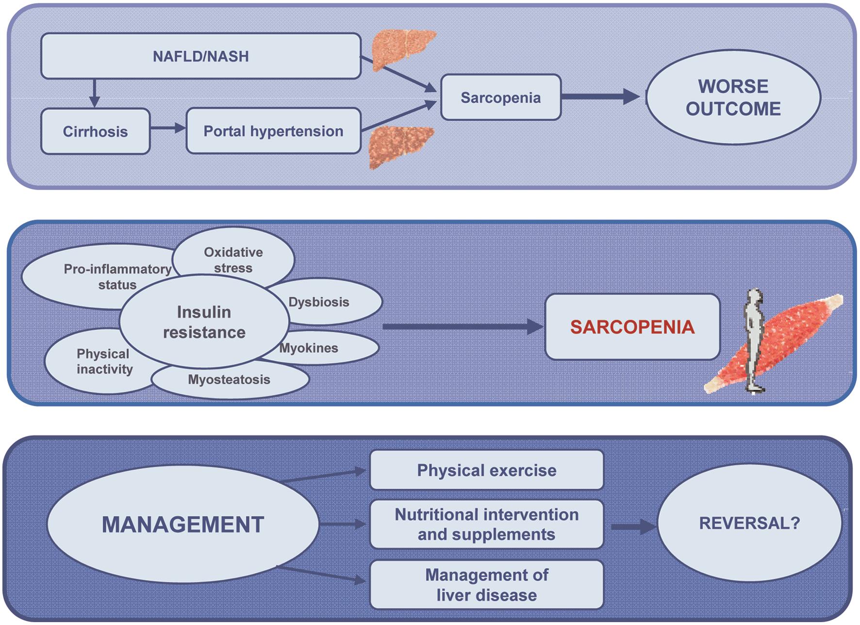 Approaching the Sarcopenic Patient with Nonalcoholic Steatohepatitis ...