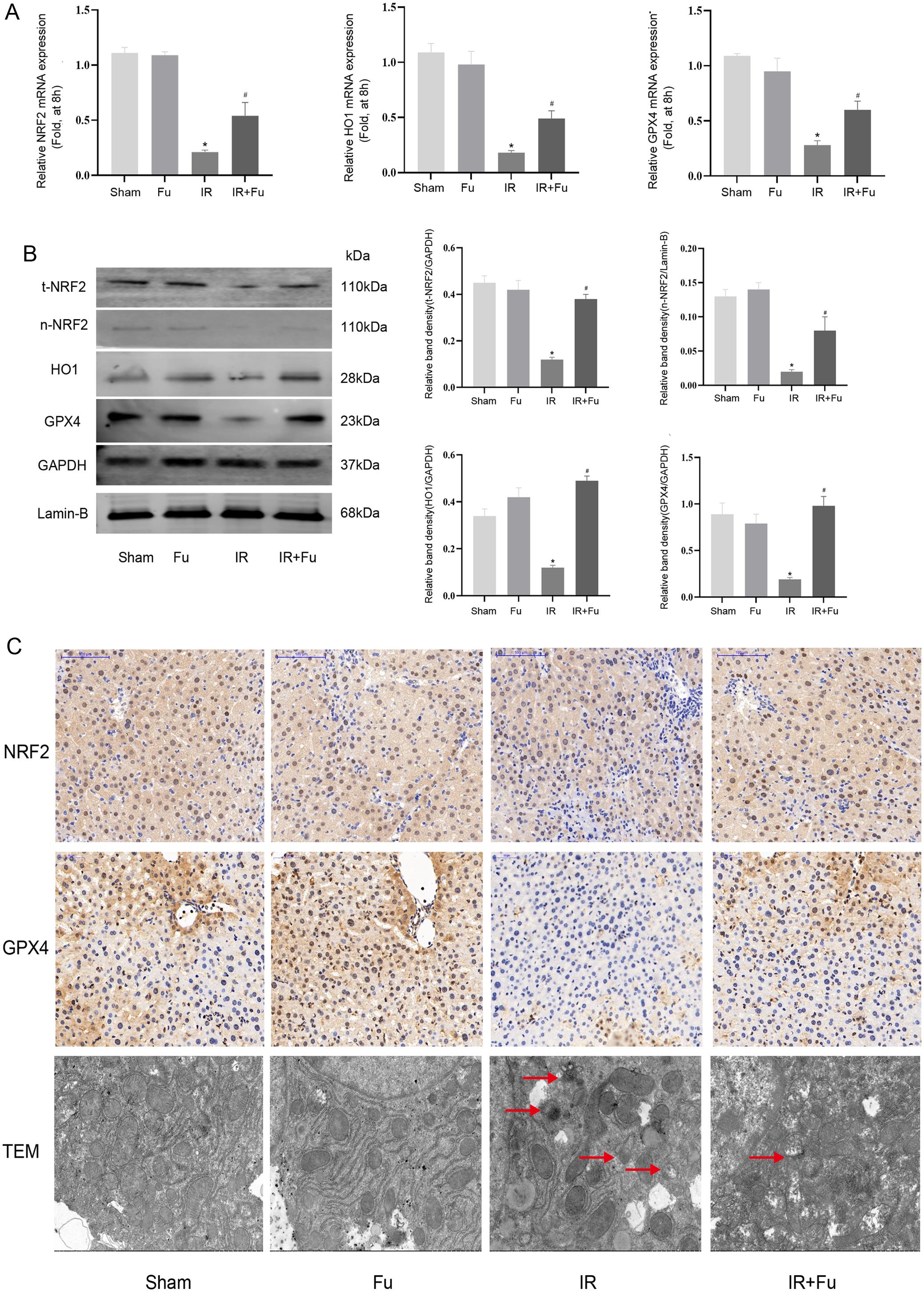 Fucoidan Ameliorates Ferroptosis in Ischemia-reperfusion-induced Liver ...