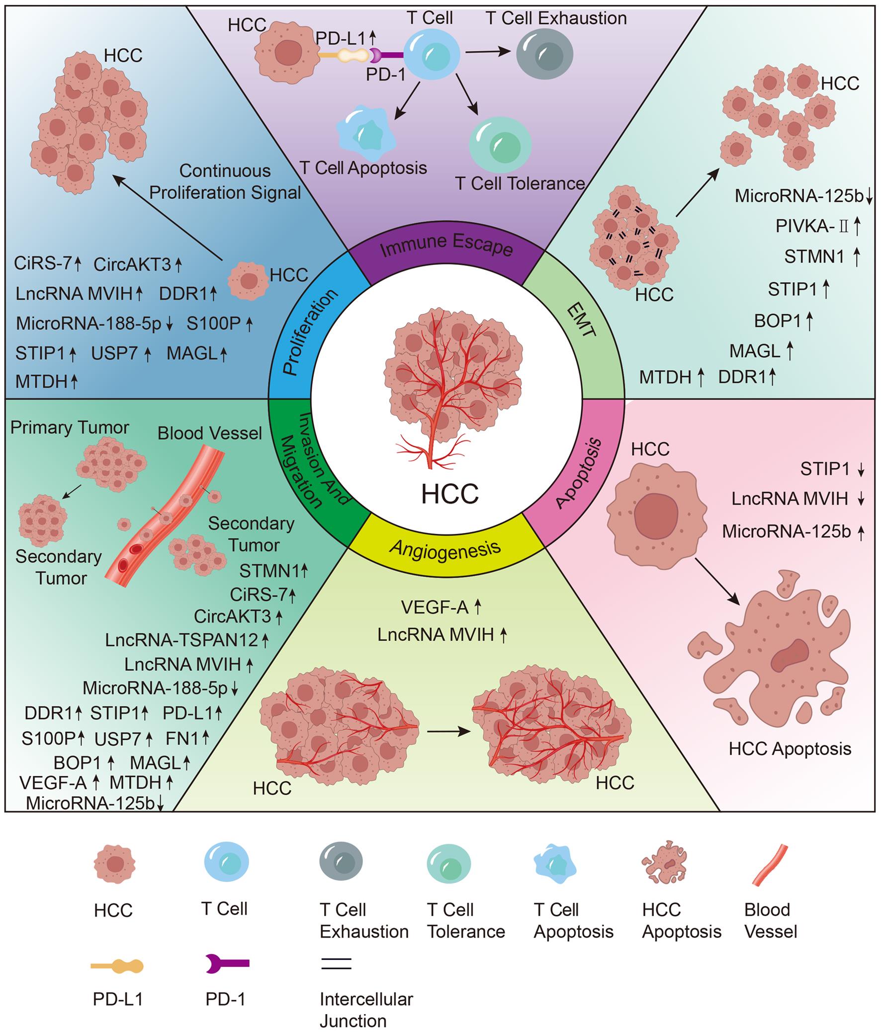 Roles and Molecular Mechanisms of Biomarkers in Hepatocellular Carcinoma with Microvascular ...