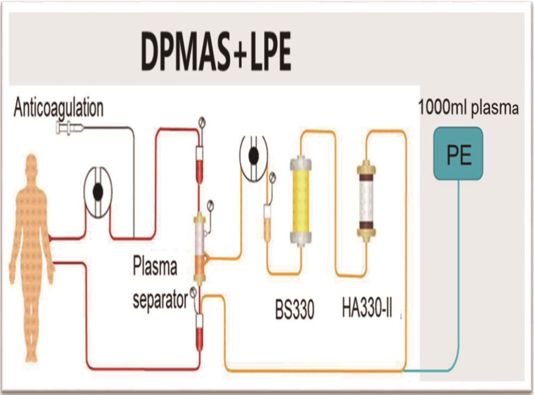 Double Plasma Molecular Adsorption System with Sequential Low-dose ...