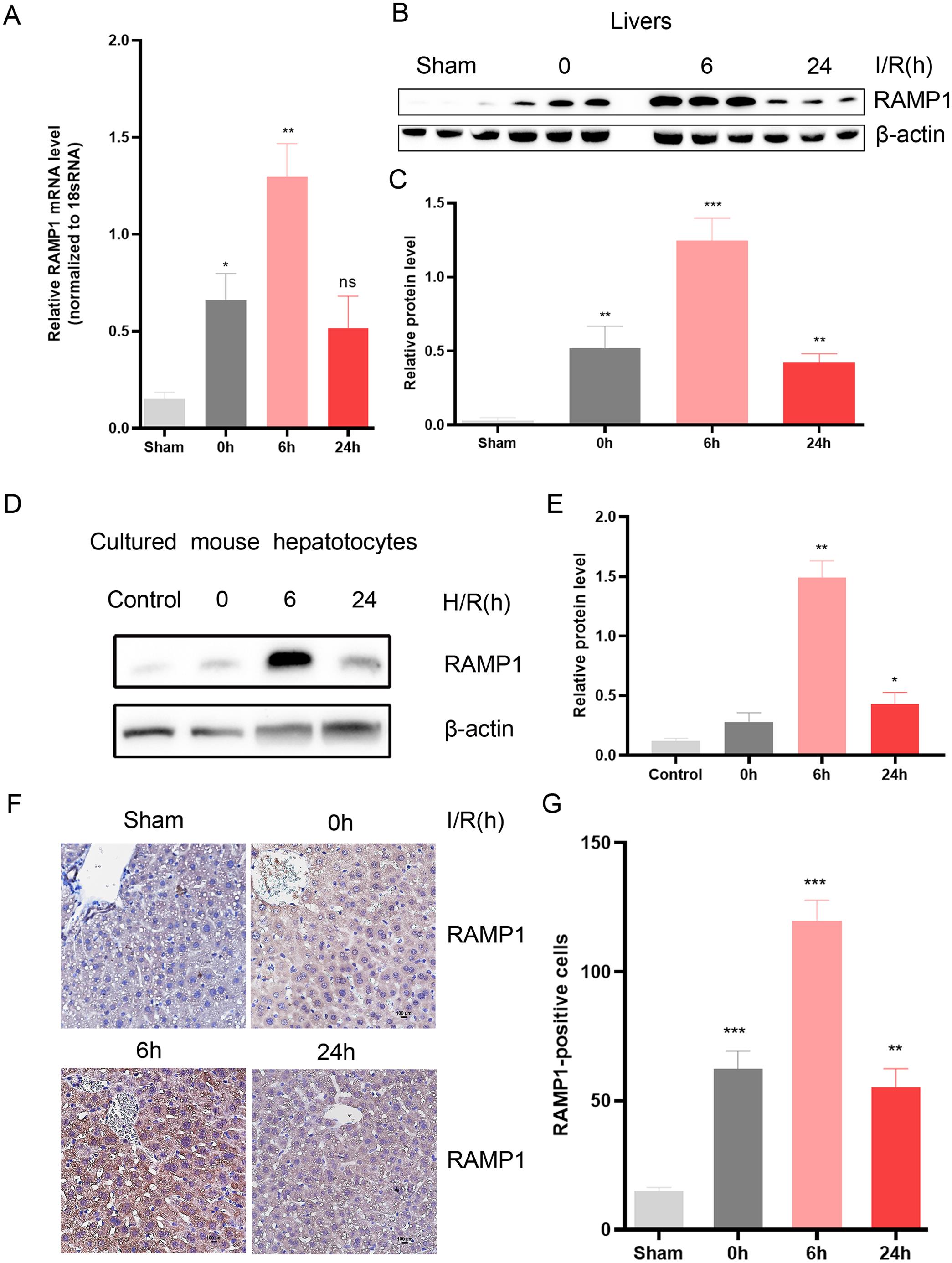 RAMP1 Protects Hepatocytes against Ischemia-reperfusion Injury by ...