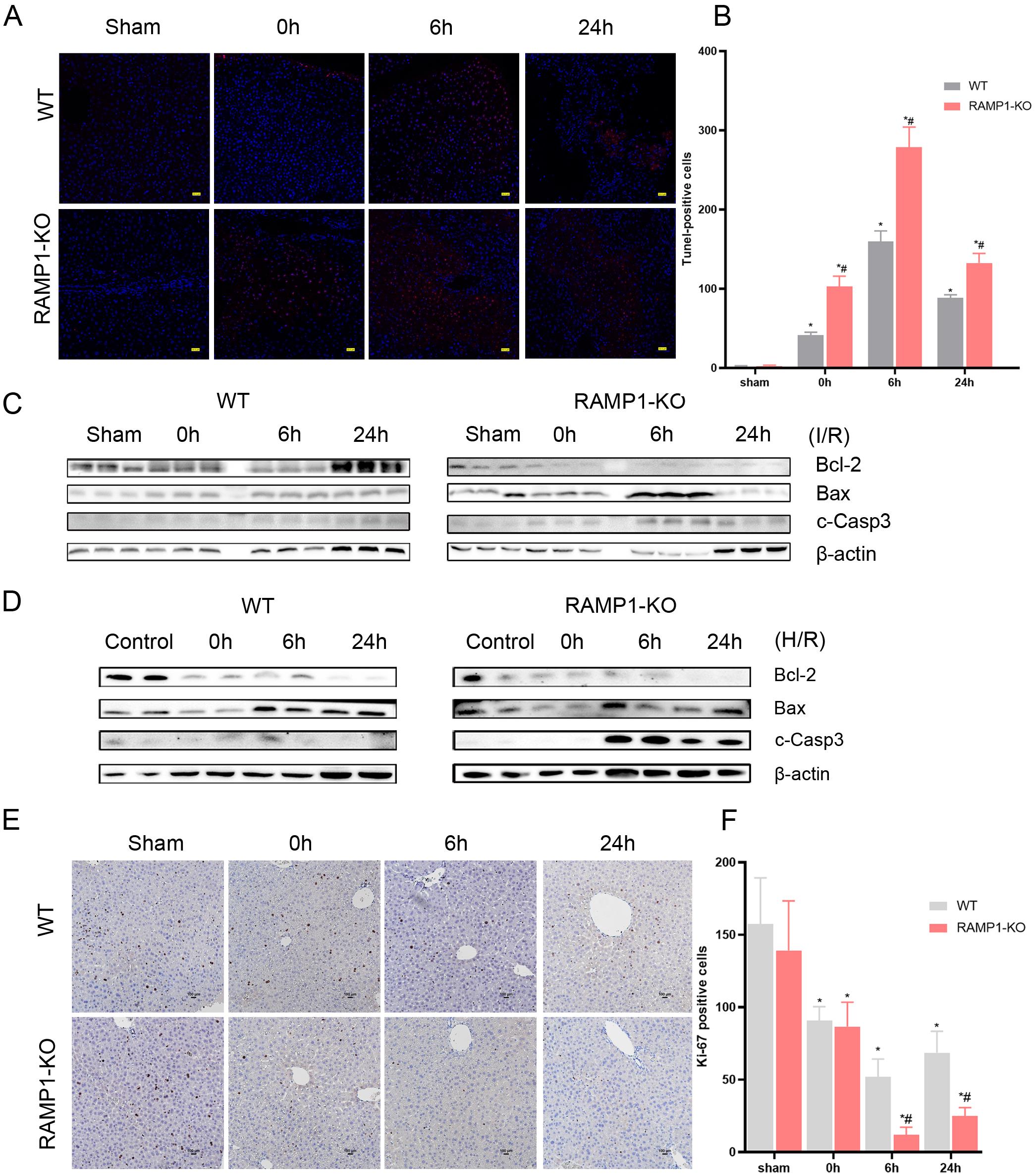 RAMP1 Protects Hepatocytes against Ischemia-reperfusion Injury by ...