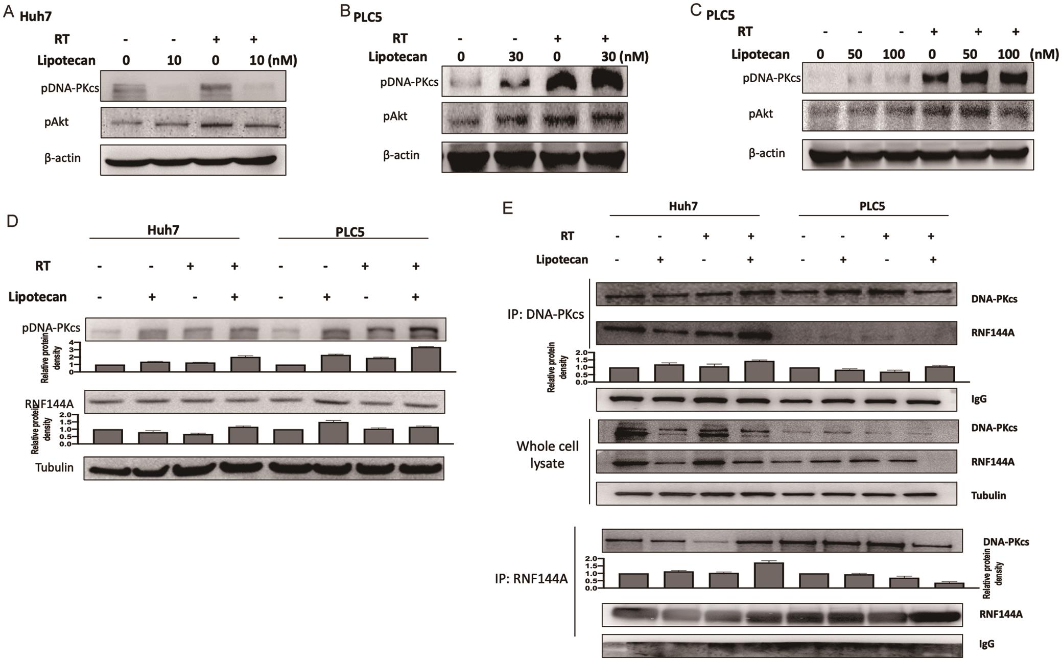 Topoisomerase I Inhibition Radiosensitizing Hepatocellular Carcinoma by ...