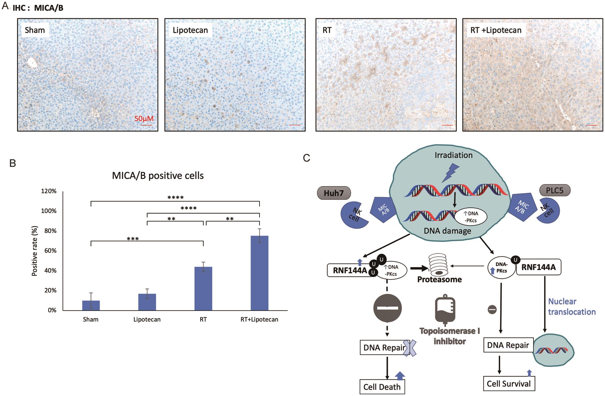 Topoisomerase I Inhibition Radiosensitizing Hepatocellular Carcinoma by ...