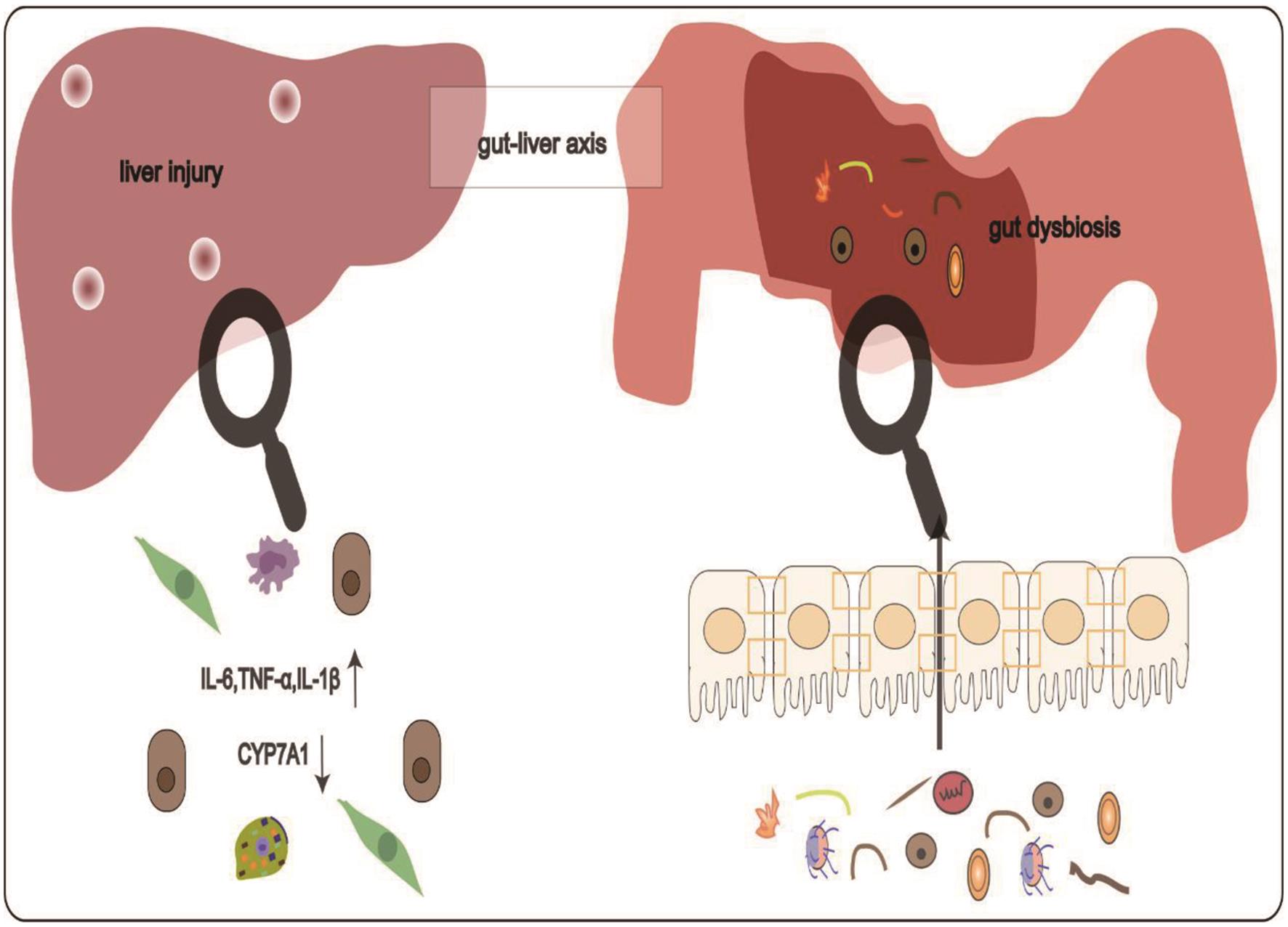 Targeting Gut Microbiota for the Treatment of Primary Biliary ...