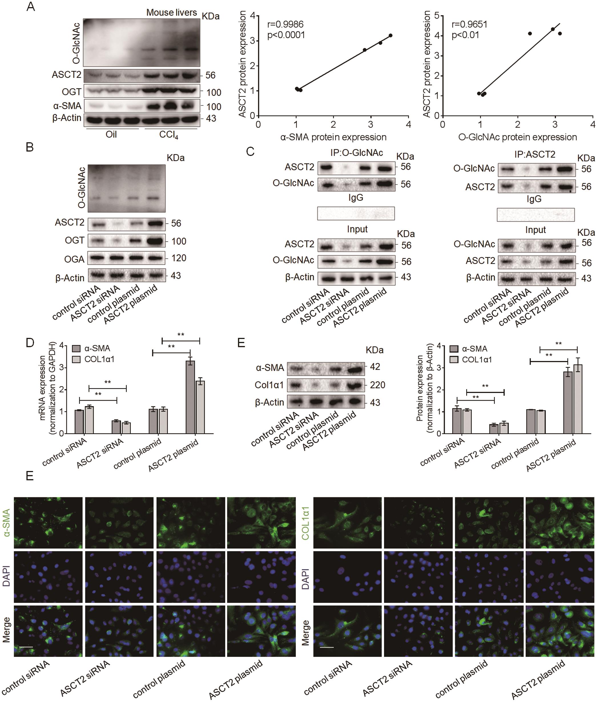 O-GlcNAcylation Coordinates Glutaminolysis by Regulating the Stability ...