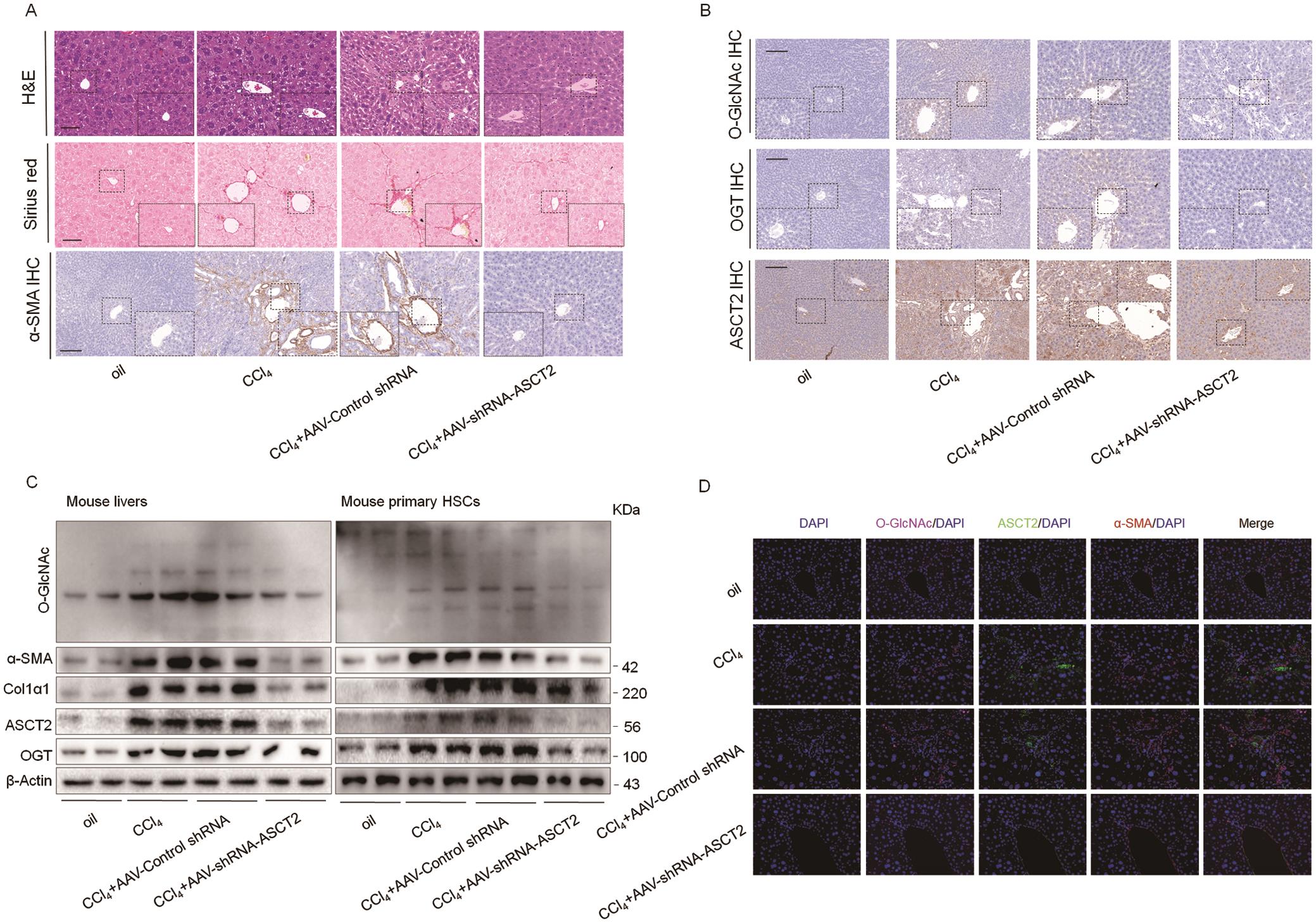 O-GlcNAcylation Coordinates Glutaminolysis by Regulating the Stability ...