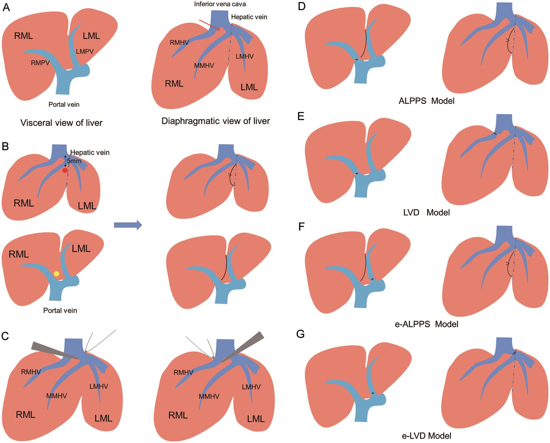 Establishment of a Rat Model of Liver Venous Deprivation: Simultaneous ...