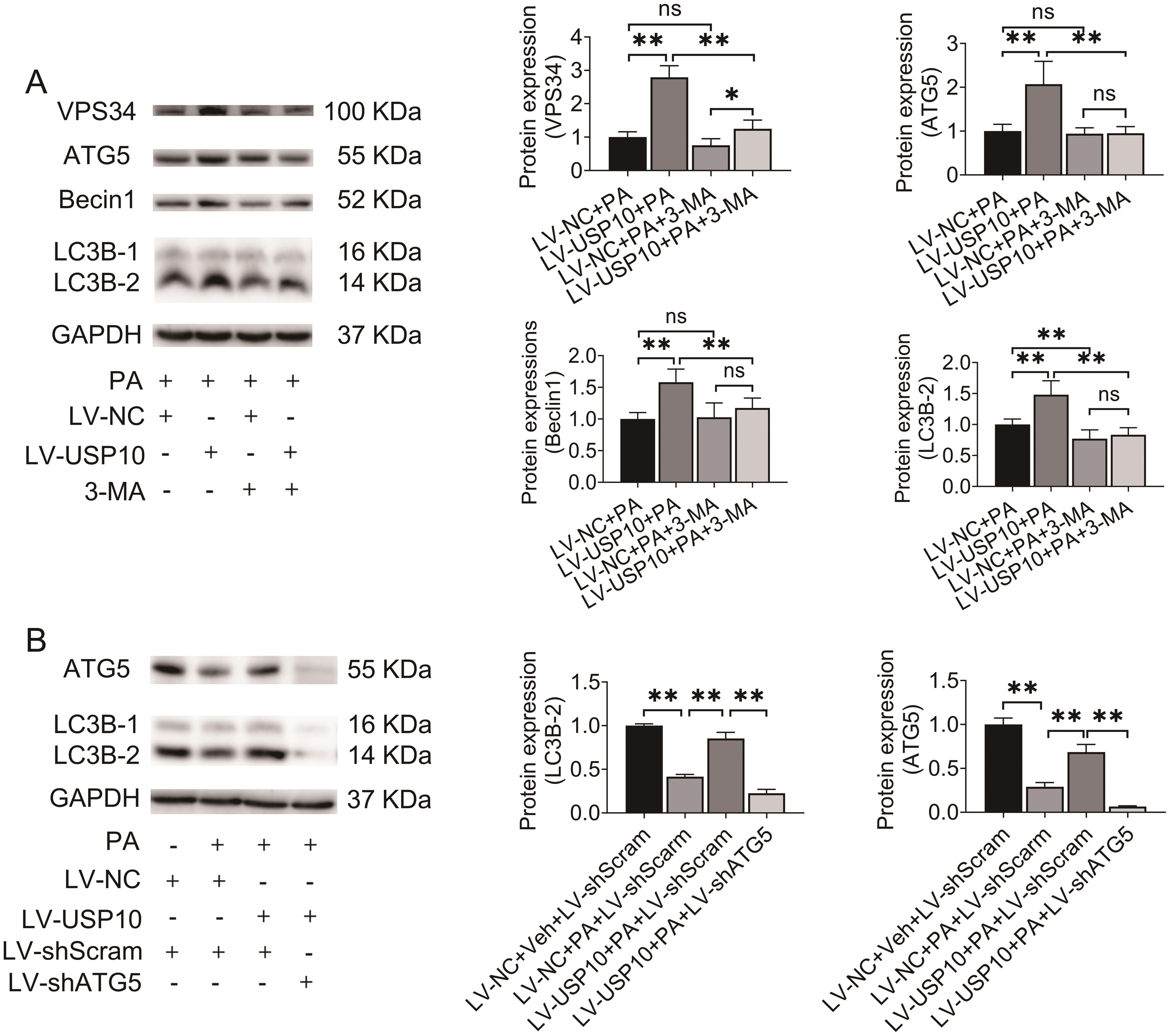 USP10 Alleviates Palmitic Acid-induced Steatosis through Autophagy in ...