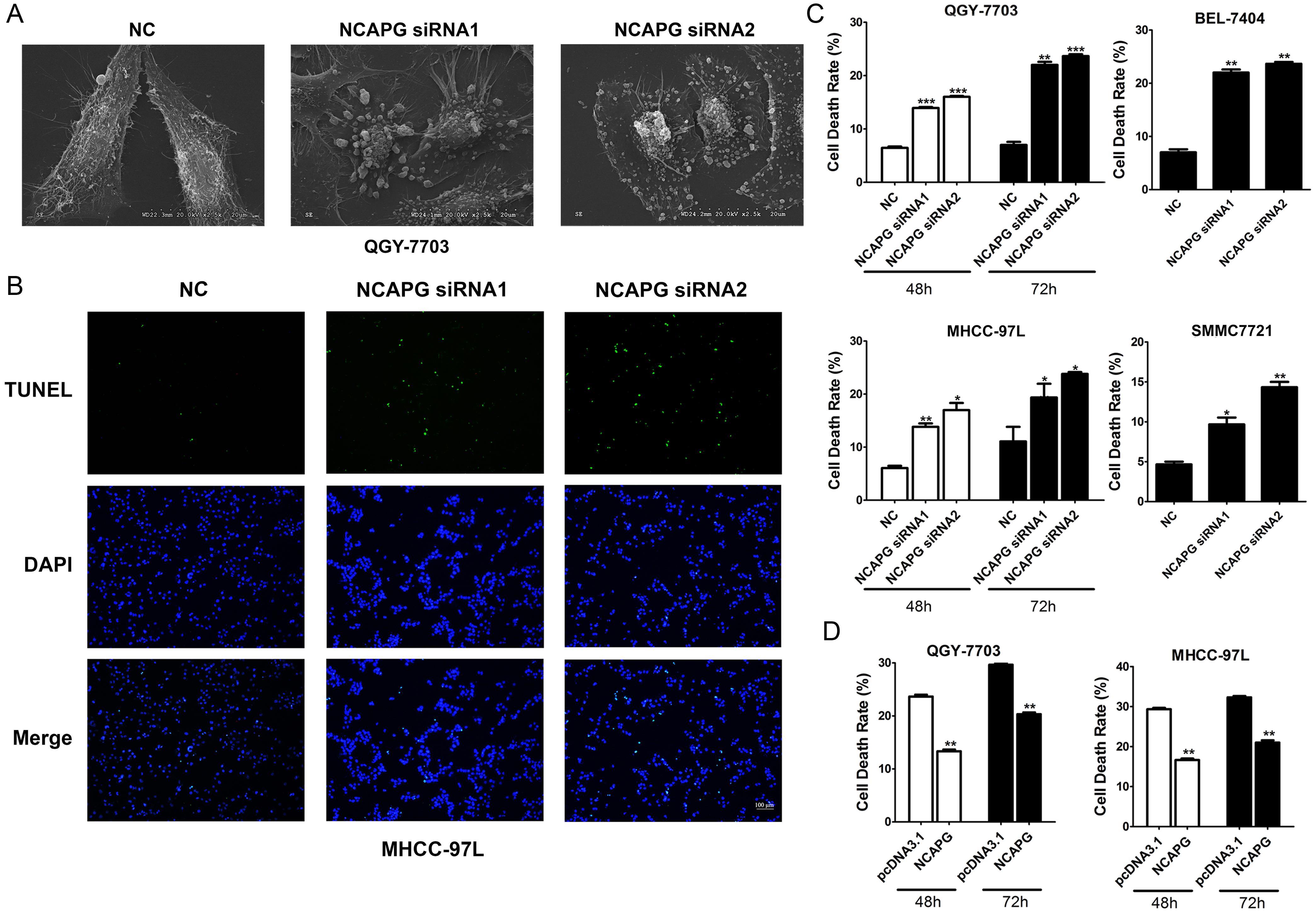 E2F1-mediated Up-regulation of NCAPG Promotes Hepatocellular carcinoma ...