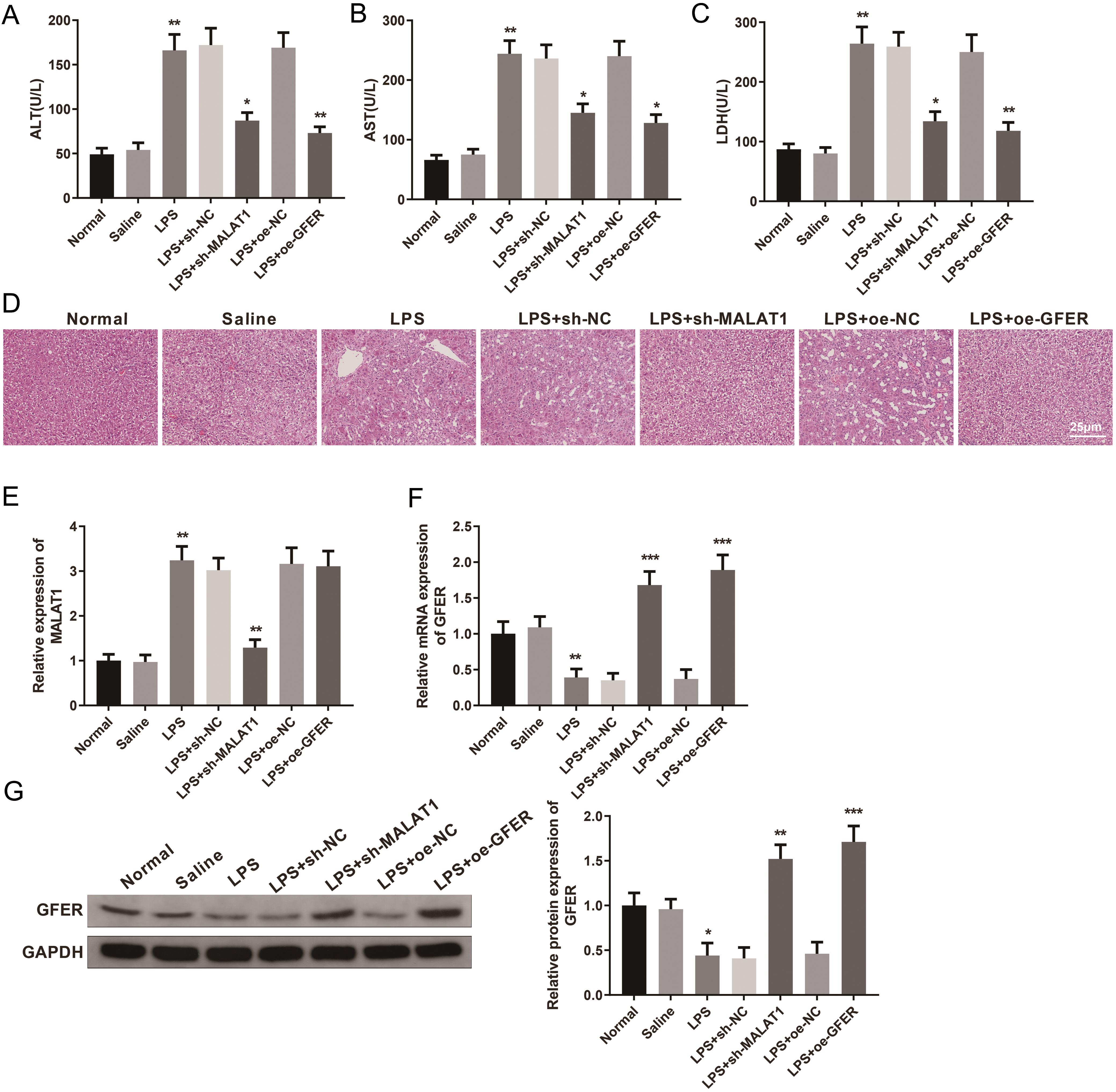 MALAT1-mediated EZH2 Recruitment to the GFER Promoter Region Curbs ...
