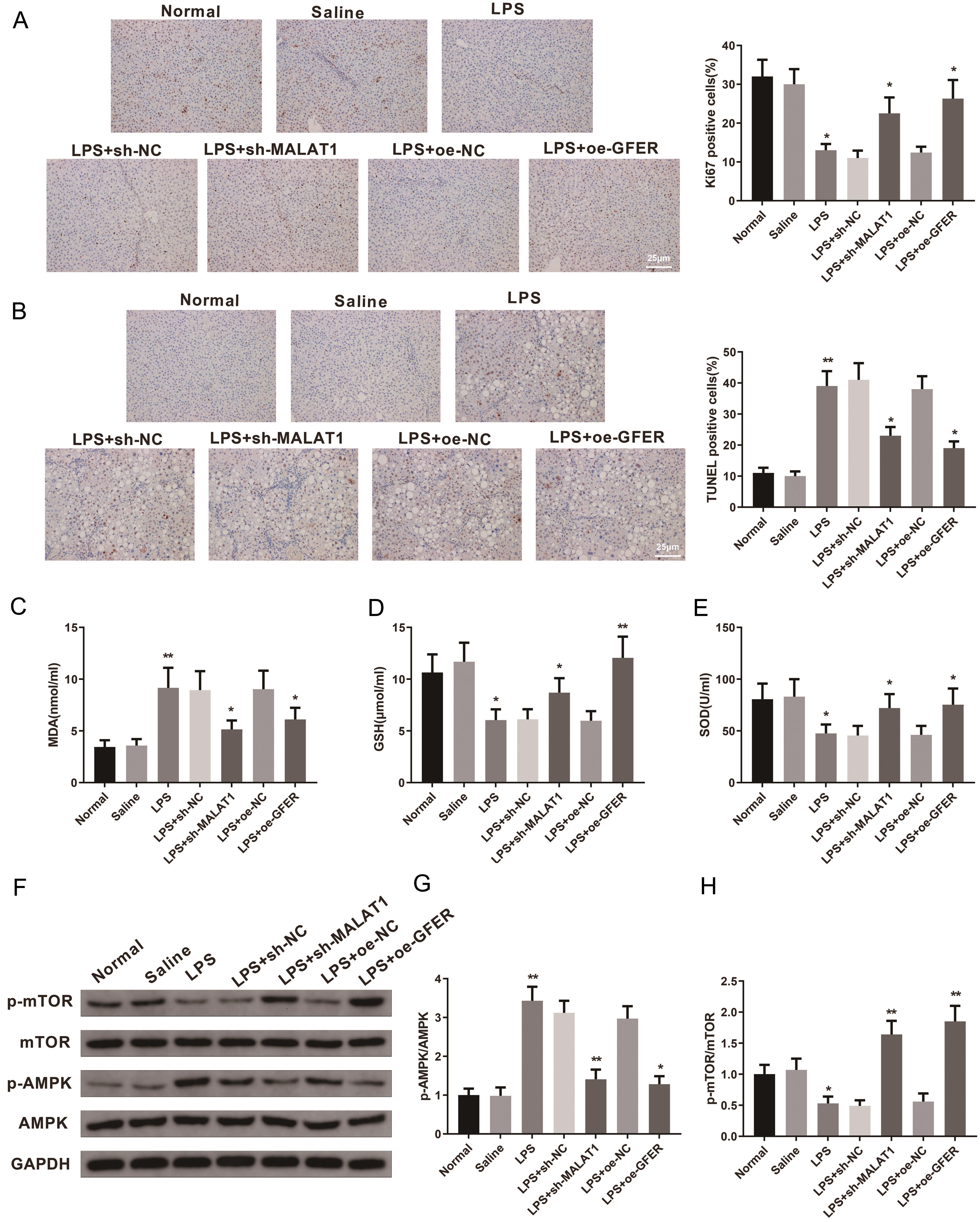 MALAT1-mediated EZH2 Recruitment to the GFER Promoter Region Curbs ...