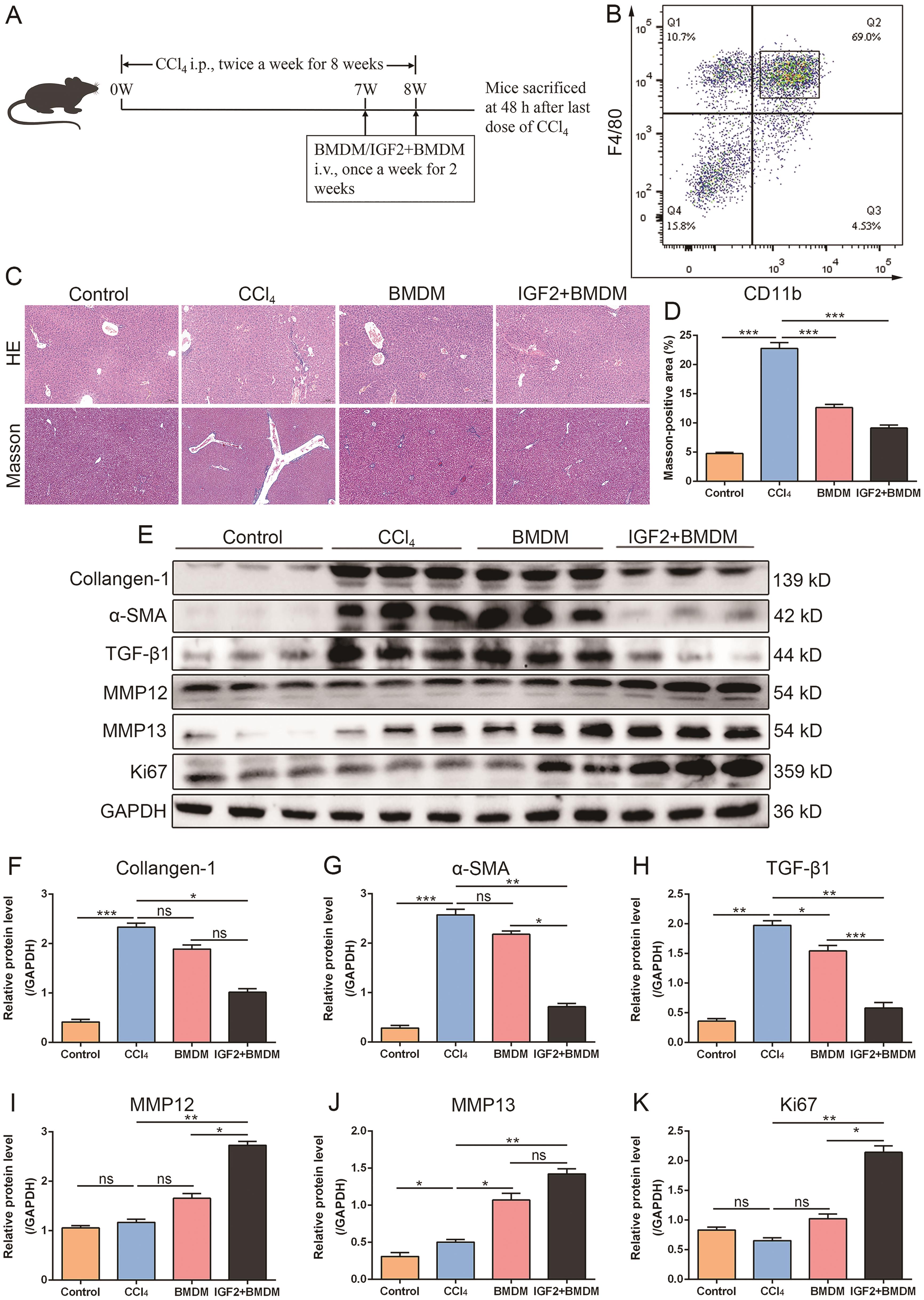 IGF2-NR4A2 Signaling Regulates Macrophage Subtypes to Attenuate Liver ...