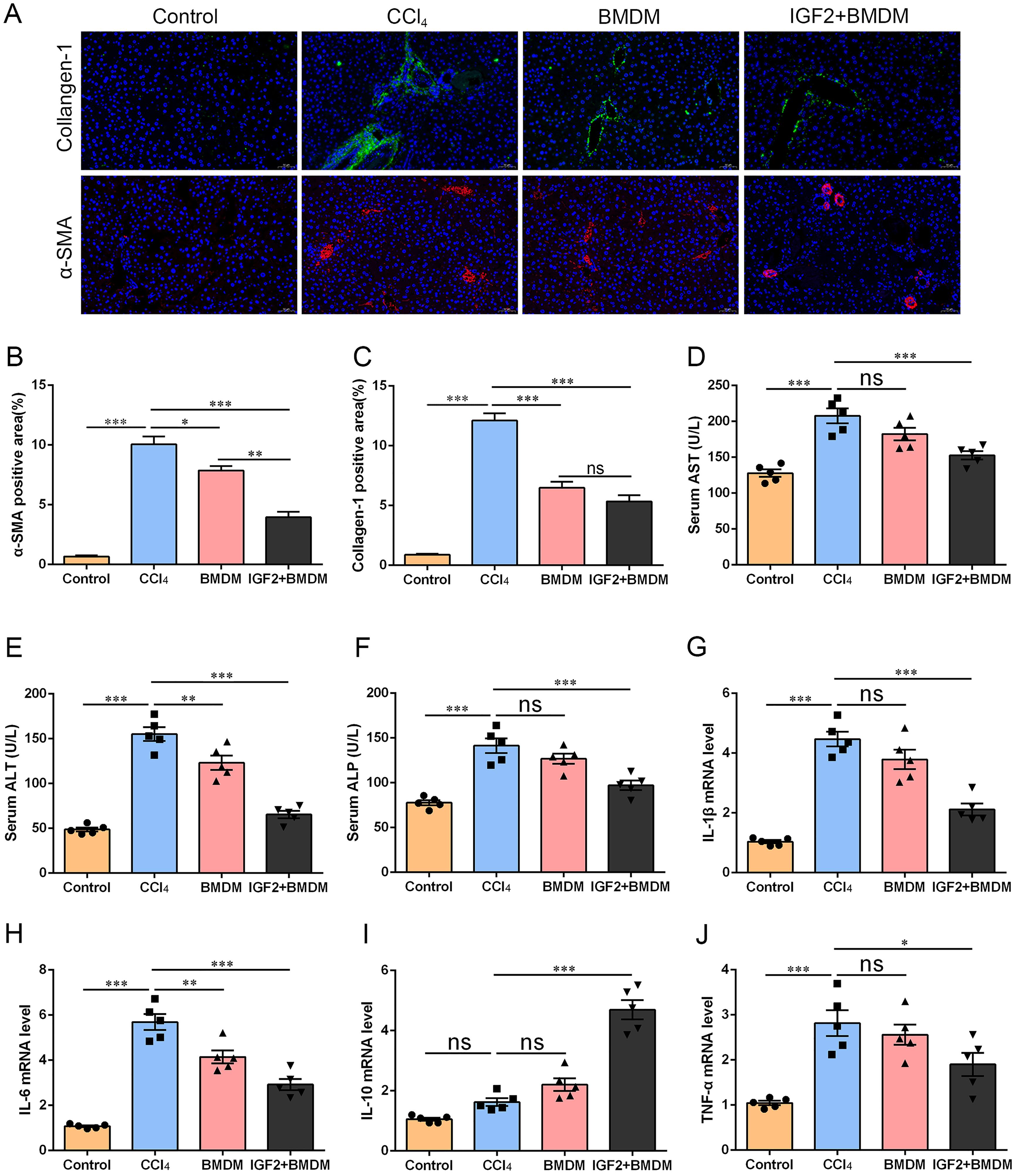 IGF2-NR4A2 Signaling Regulates Macrophage Subtypes to Attenuate Liver ...